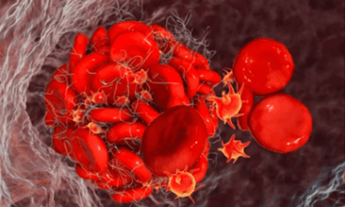 Technologies for Vascular Intervention - Elixir Medical